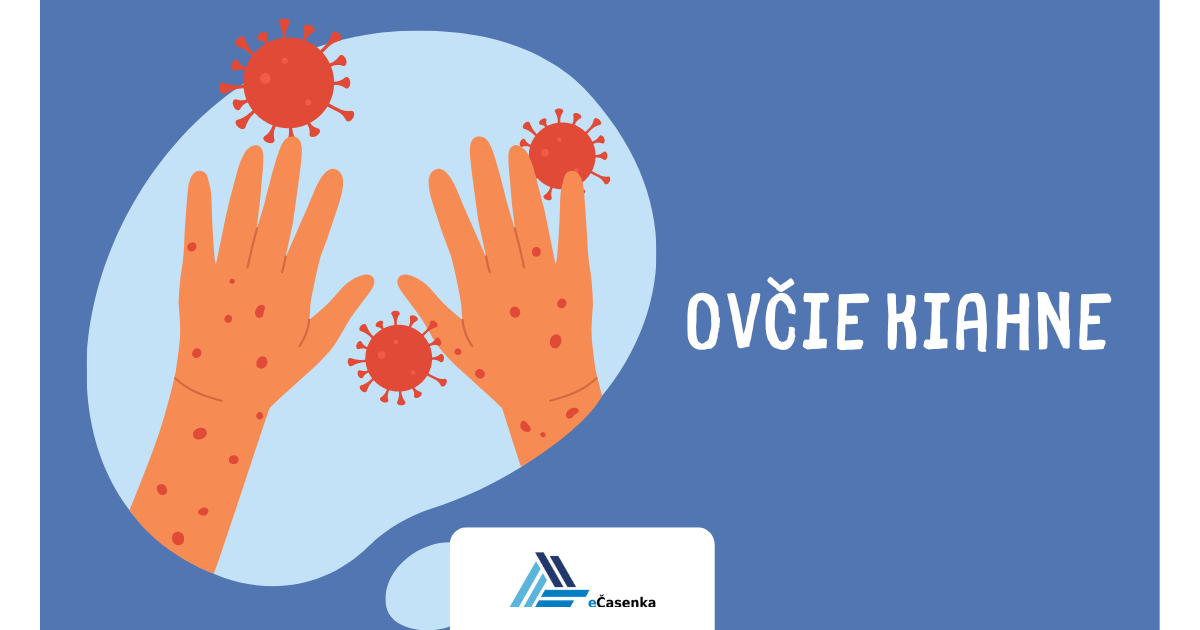 Ovčie kiahne – príčiny, priebeh a liečba | eČasenka.sk