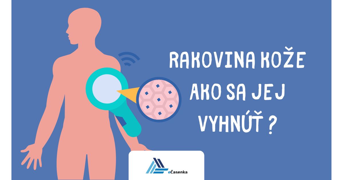 Viditeľné prejavy a príznaky rakoviny kože | eČasenka.sk